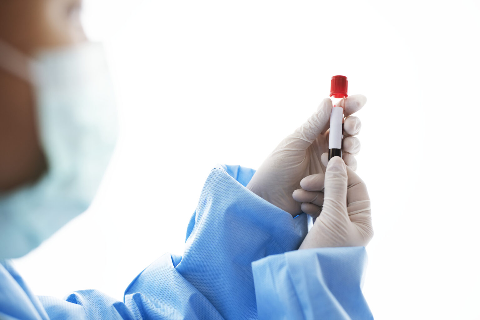 Does Sjogren’s Syndrome Always Show Up in A Blood Test? | Personalabs