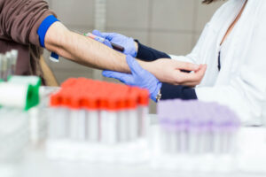 Blood Test for Smoking: What You Need To Know About the Nicotine ...